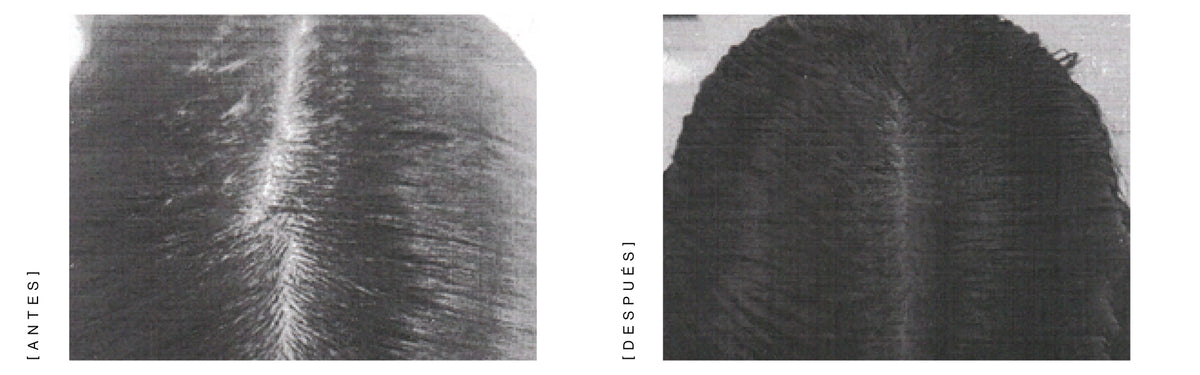 FoliGrow: Shampoo Triple-Acción Anticaída