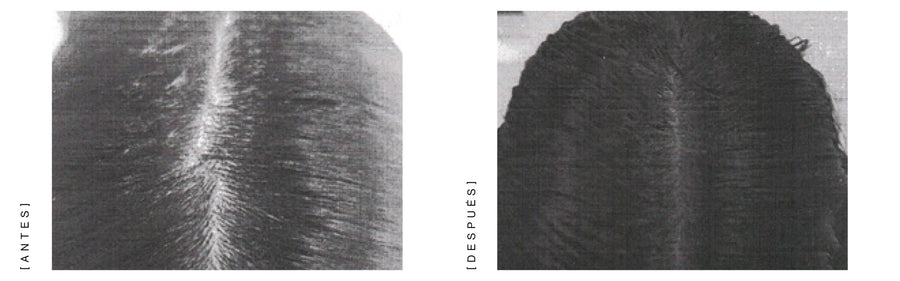 FoliGrow: Shampoo Triple-Acción Anticaída